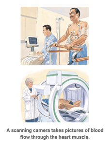 Nuclear Cardiac Imaging – Wyoming Cardiopulmonary Services, PC